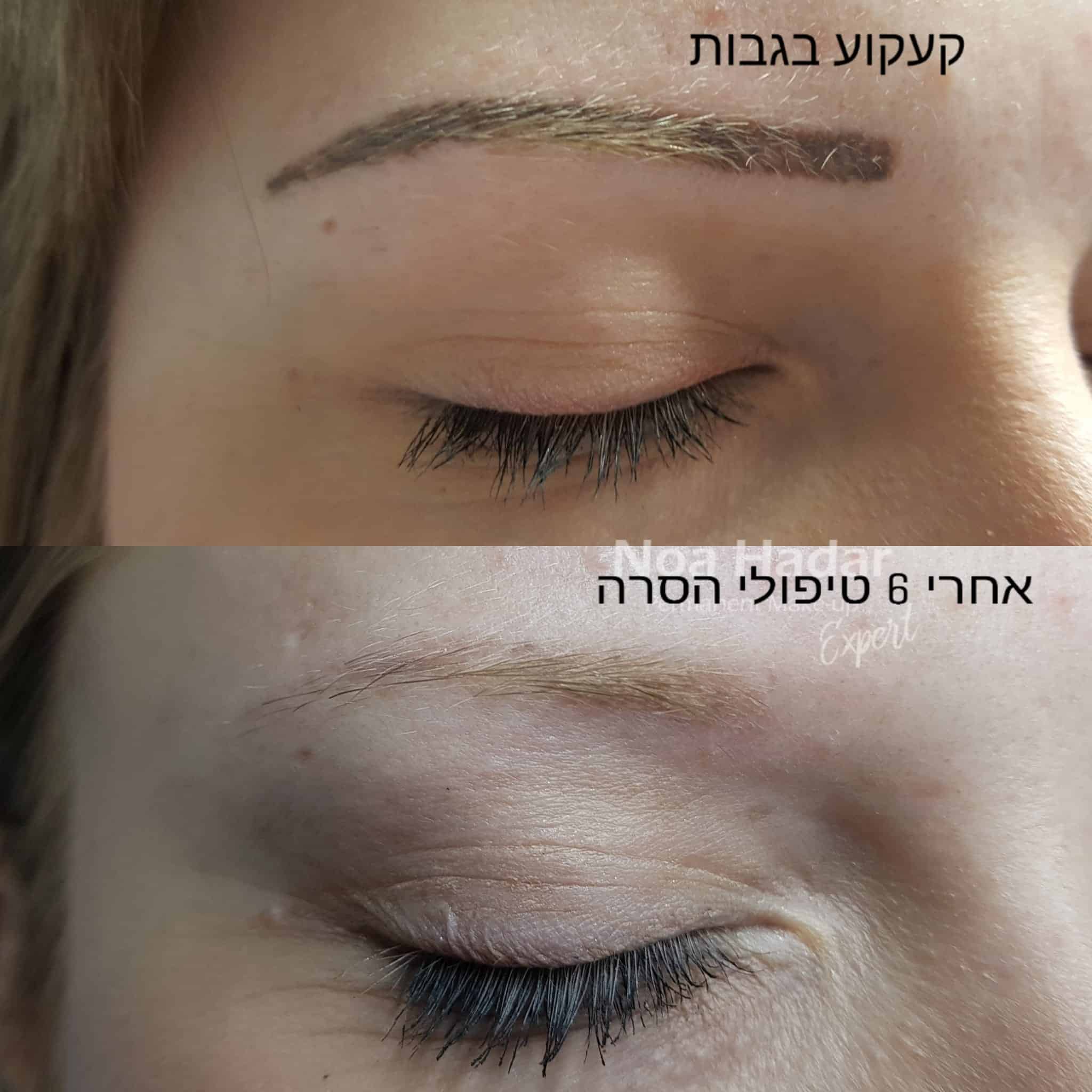 ירין עמר - הלנה עולם היופי